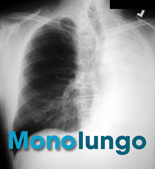 Having only one lung - a collection of songs - The Spotify Community